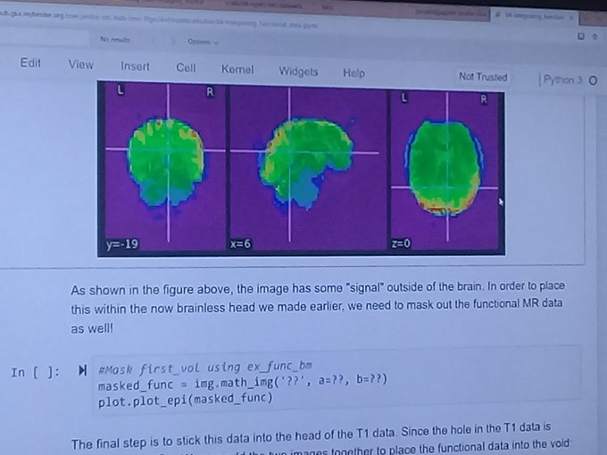 BrainHack Toronto 2019: Learnings from the Python Neuroimaging Workshop ...